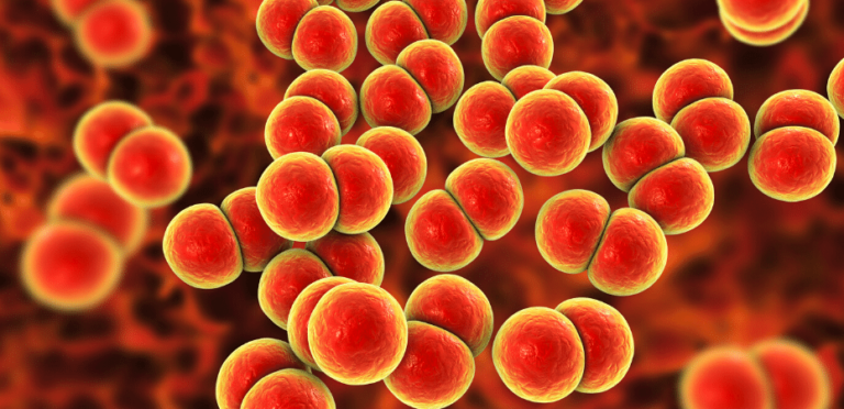What Causes Epithelial Cell Abnormality?