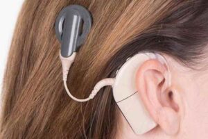 Auditory Brainstem Implant vs Cochlear Implant | Key Differences Explained