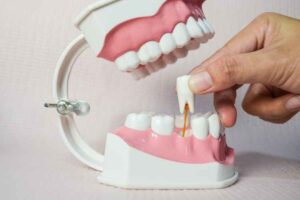 How to Permanently Kill a Tooth Nerve: Safe Remedies to Relieve Toothache
